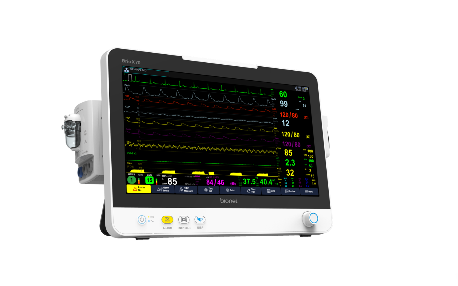 PATIENT MONITOR - Bionet Europe GmbH